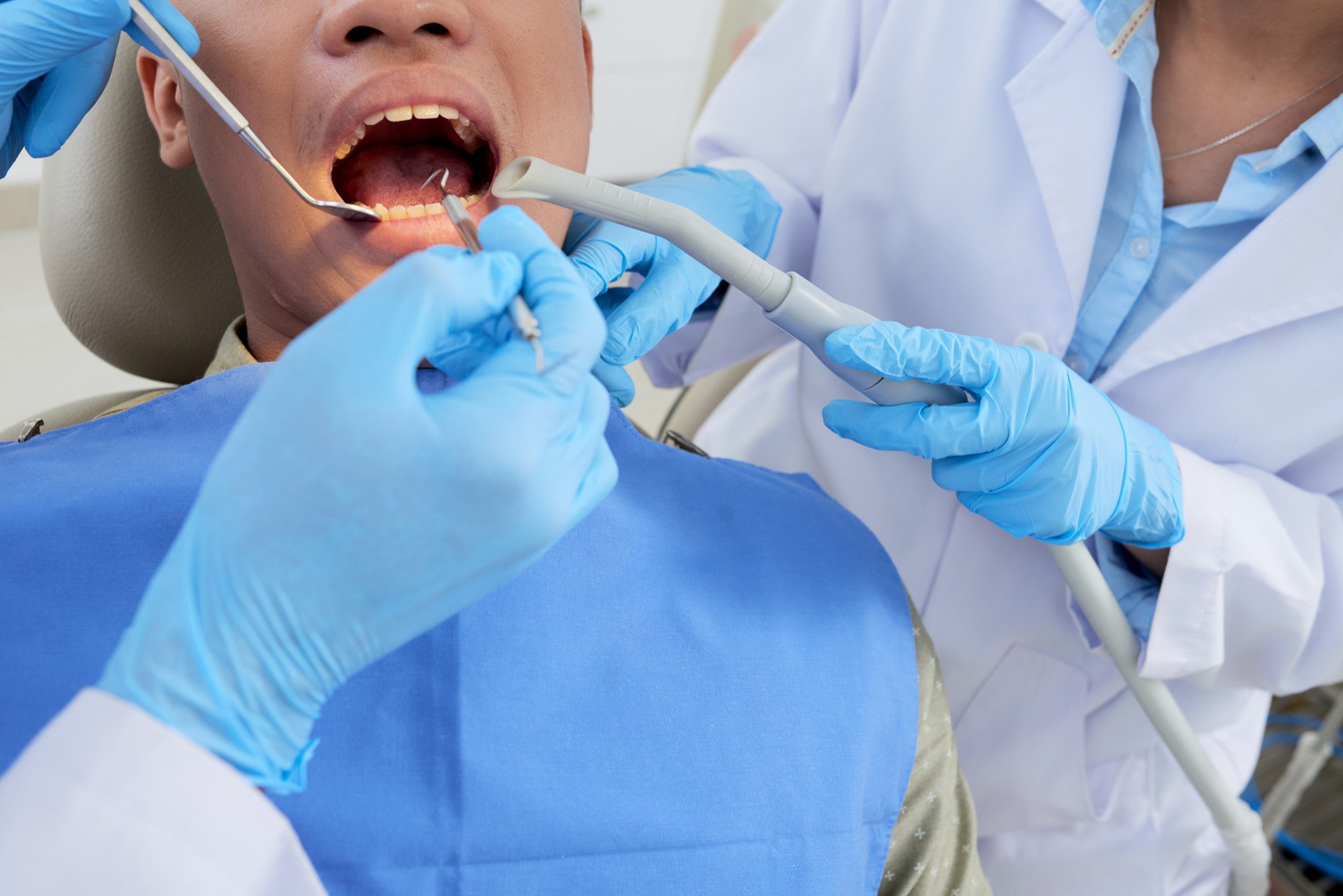 Wisdom Tooth Extractions In Tel Aviv